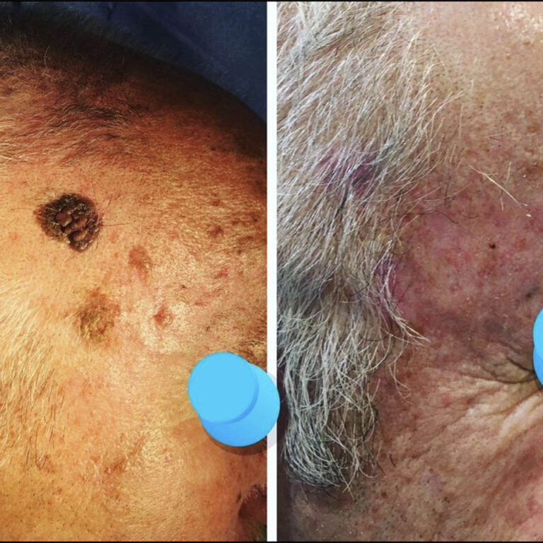 Stratford Dermatherapy Clinic | Warwickshire's leading cosmetic clinic